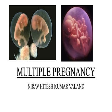 Managing Multiple Pregnancies | PPT
