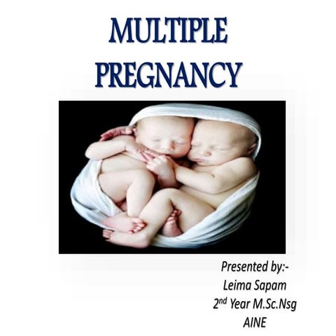 Multiple pregnancy | PPTX | Pregnancy | Reproductive Health