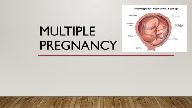 TWIN PREGNANCY | PPTX