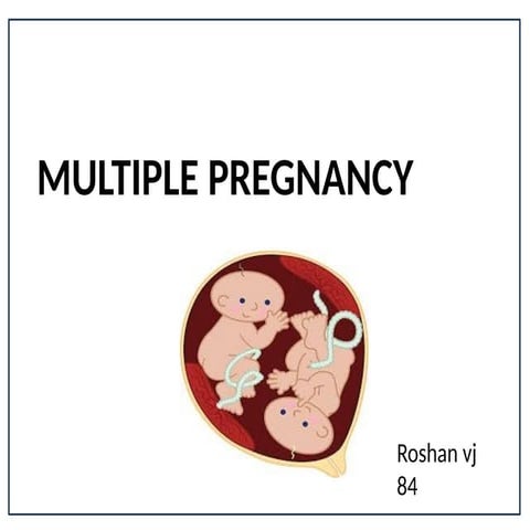 multiple pregnancy obstetricsand gynaneac..pptx