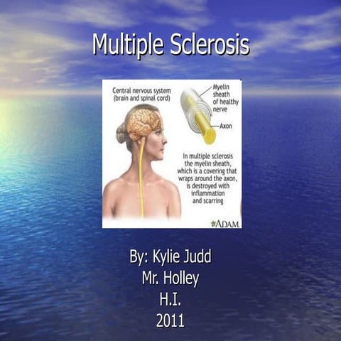 Multiple sclerosis | PPT
