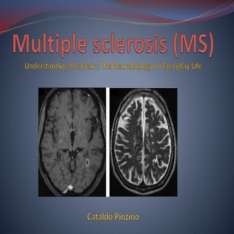Multiple sclerosis | PPT