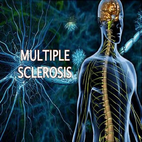 Multiple sclerosis | PPTX