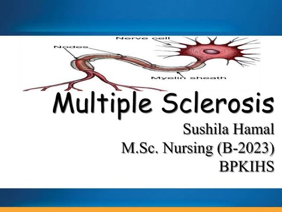 ICD-10 Codes for Multiple sclerosis (MS) | PDF