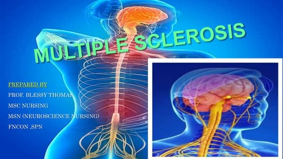 Multiple sclerosis (MS) | PPT