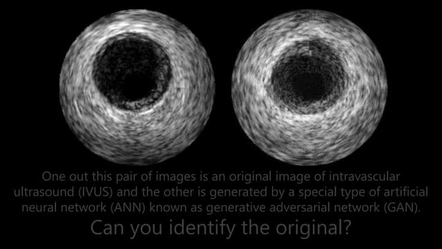 Multitask Adversarial Learning Of Deep Neural Networks For Medical Imaging And Image Analysis Ppt 0697