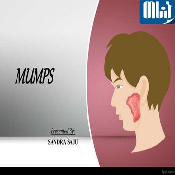 Mumps | PPT