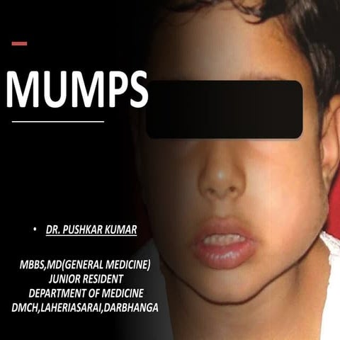 Mumps.pptx