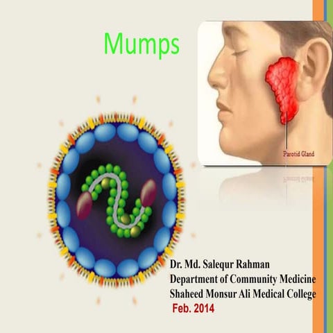 Mumps | PPT
