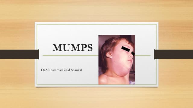 Mumps | PPTX