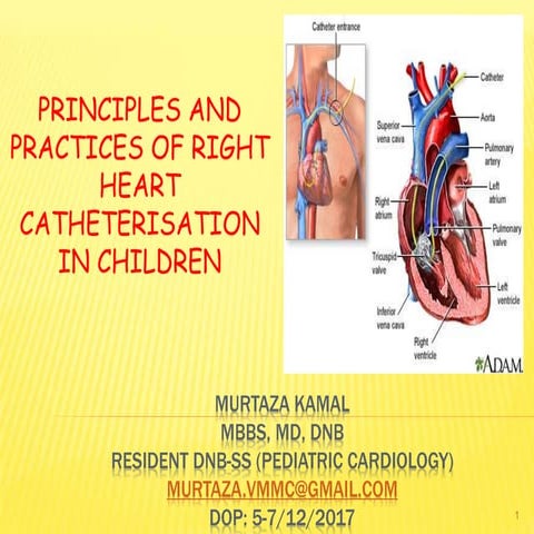PRINCIPLES AND PRACTICES OF RIGHT HEART CATHETERIZATION IN CHILDREN | PPTX