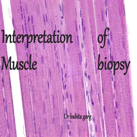 muscle biopsy site indications staining processing of muscle biopsy.pptx