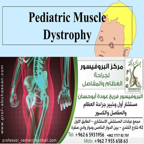 امراض العضلات عند الاطفال- Pediatric Muscle dystrophy- - البروفيسور ...