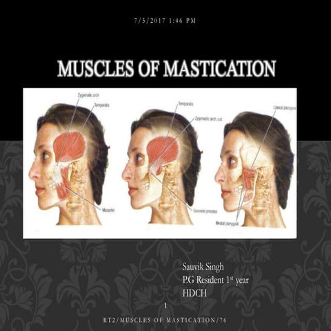 Muscle of mastication | PPT