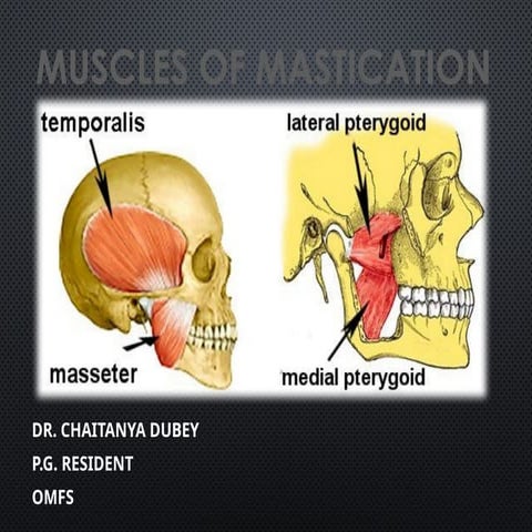 MUSCLES OF MASTICATION .pptx presentation | PPT