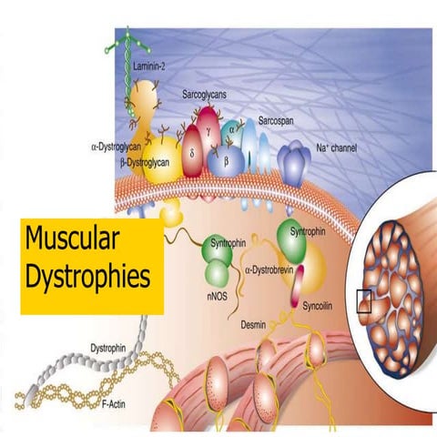 musculardystrophies--2.ppt
