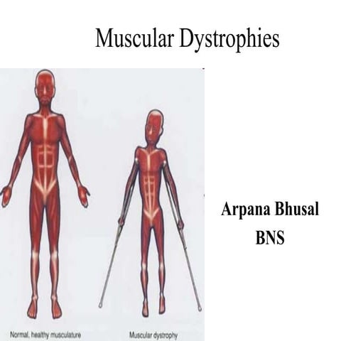 Muscular Dystrophies | PPT