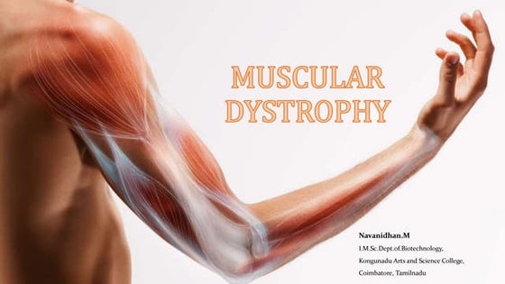 DUCHENNE MUSCULAR DYSTROPHY | PPTX