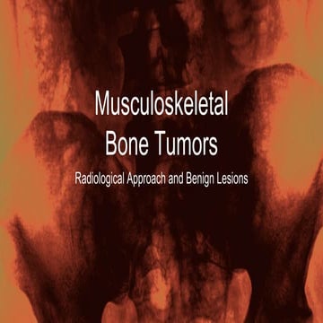 Imaging of benign bone tumors | PPTX