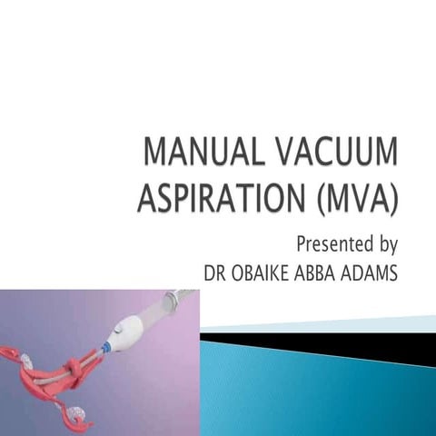 Ecv- External Cephalic Version- Define, Risk, procedure, step, benefits ...