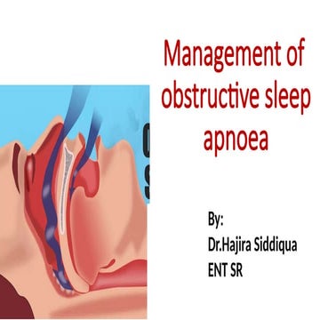 Management of obstructive sleep apnea.pptx