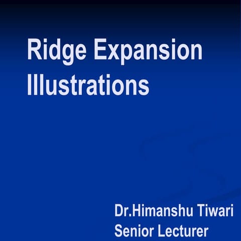 Ridge Expansion Illustration | PPT