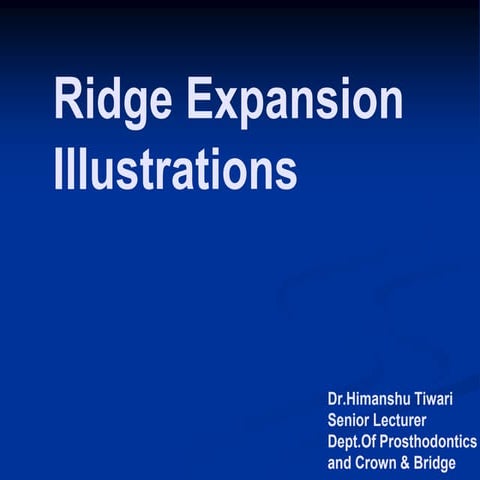 Ridge Expansion Illustration | PPTX