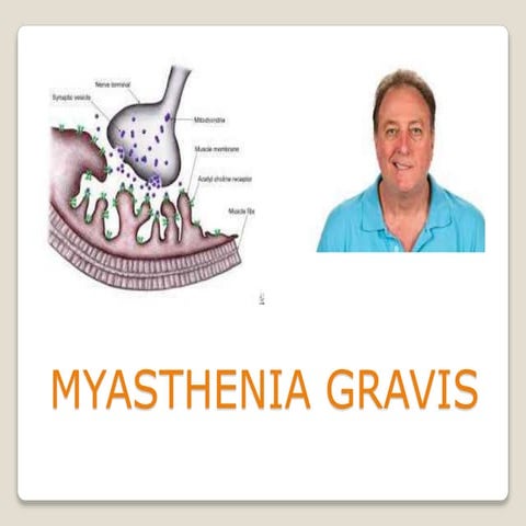 MYASTHENIA GRAVIS: etiology, pathophysiology, clinical manifestations ...