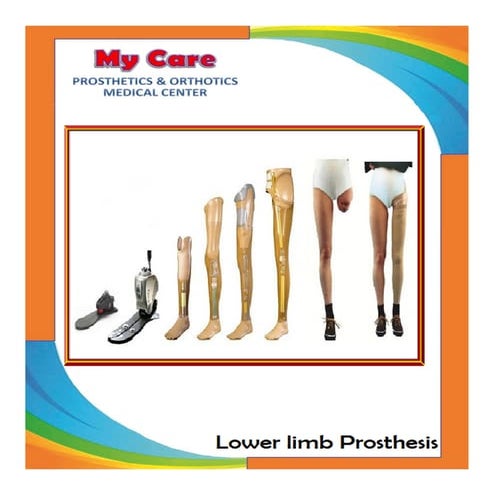 Artificial limbs Orthotic insoles polio callipers orthopedic shoe | PDF