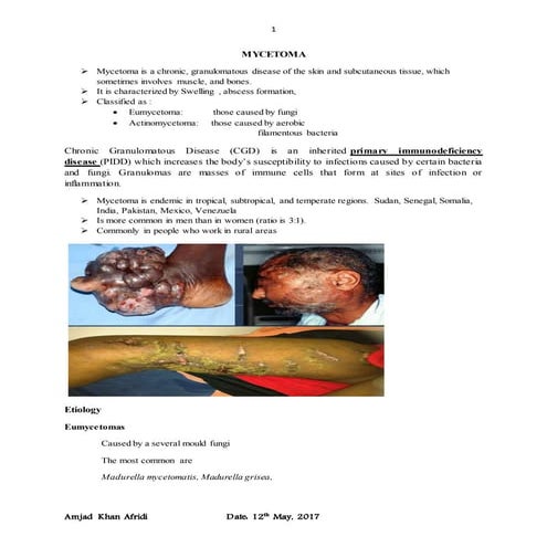 Mycetoma | DOCX