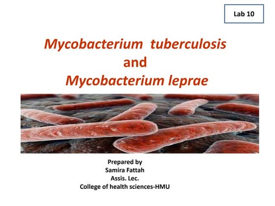 Tuberculosis ppt | PPT