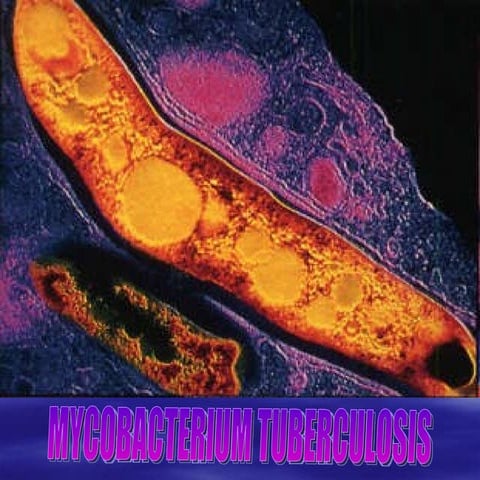 Mycobacterium tuberculosis seminar | PPT