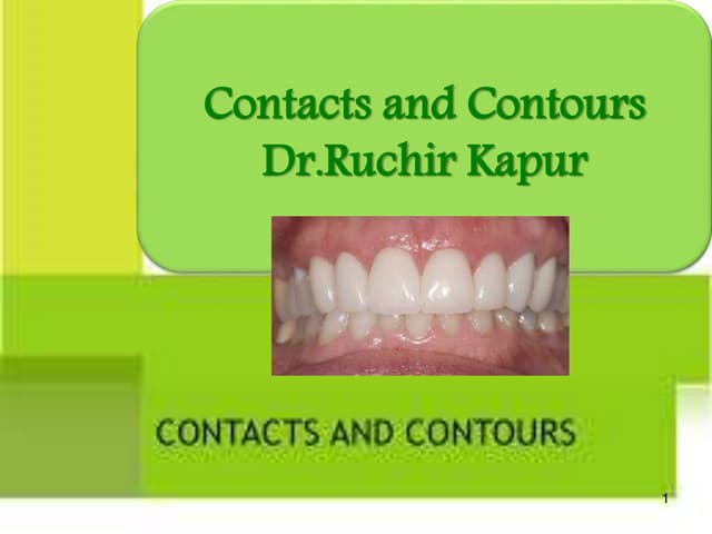 Components of a complete denture | PPTX