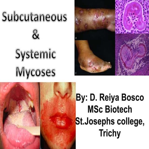 subcutaneous Mycosis & systemic mycosis | PPTX