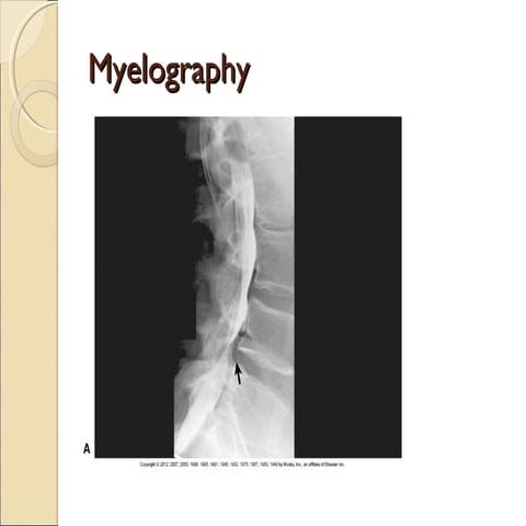 Myelogram rad 205-2011 | PPT