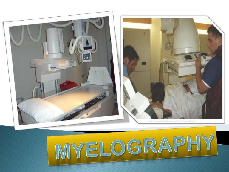Myelography