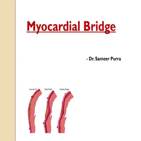 myocardialbridging-241209050404-439550b3 - Copy.pptx