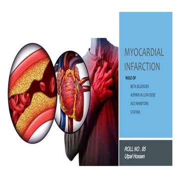 01 S P M P On Acute Ischemic Stroke | DOCX