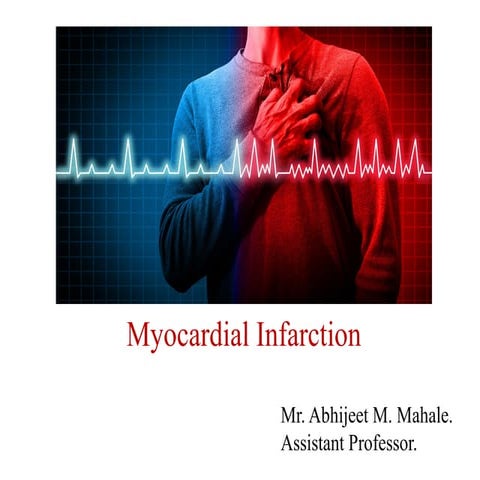 CAD AND MI (CORONARY ARTERY DISEASE AND MYOCARDIAL INFARCTION) | PDF
