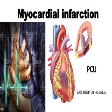 myocardial infarction pcu_n.pptx