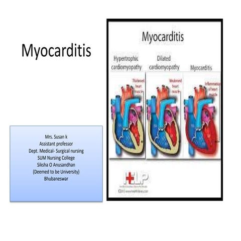 Myocarditis | PPTX