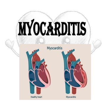 Myocarditis - short ppt for nursing students | PPTX