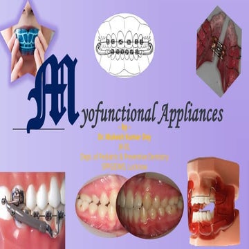 Myofunctional Appliances | PPTX
