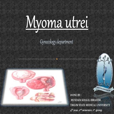 Myoma utrei (Fibroleiomyoma, Fibroma) | PPTX | Pregnancy | Reproductive ...