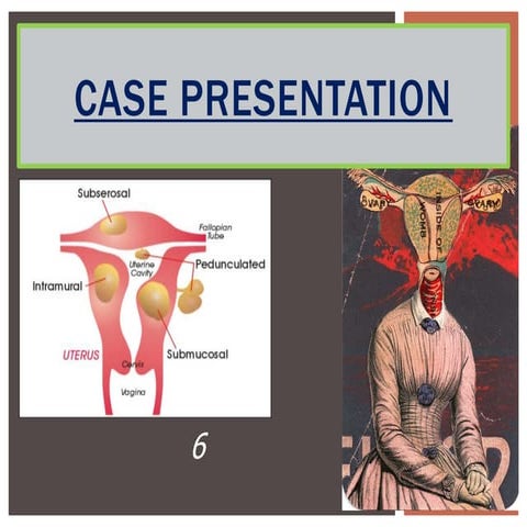 Myoma uteri presentation | PPTX