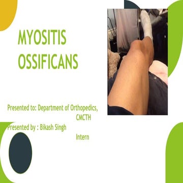 Myositis ossificans for mbbs and residents.pptx