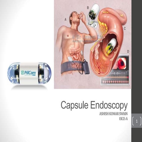 capsule endoscopy | PPT