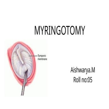 myringotomy of TM otorhinolarngology.pptx