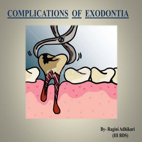 Extraction of retained roots. | PPTX