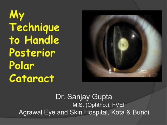 INCISIONS IN CATARACT SURGERY.pptx
